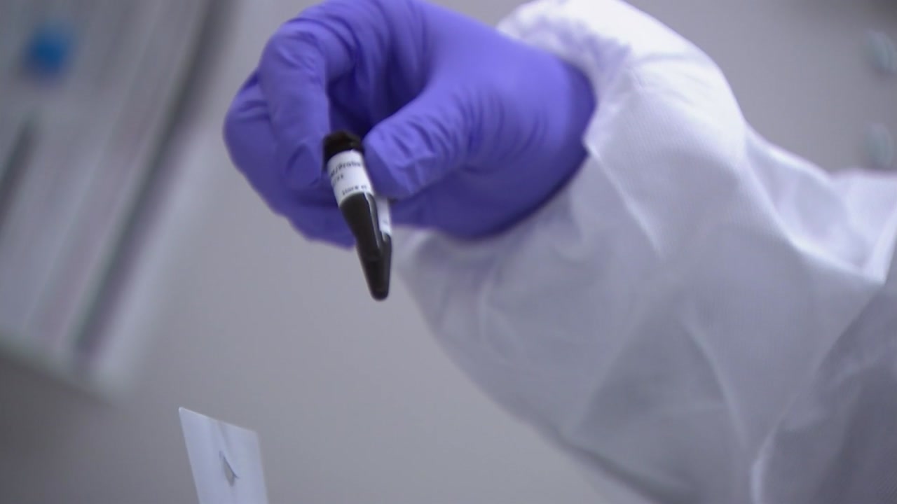 [사회]국내 오미크론 확진 625명...오늘부터 신속 PCR 시약 도입 | YTN