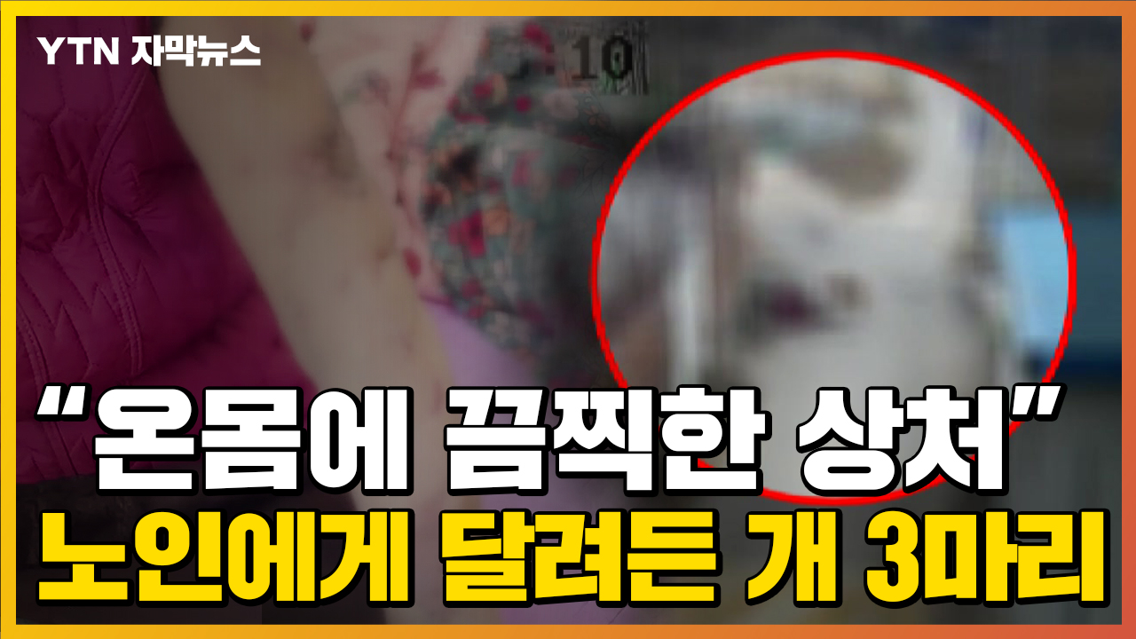 [자막뉴스] 80대 노인에게 달려든 사냥개 3마리...또 '개 물림' 사고 | YTN