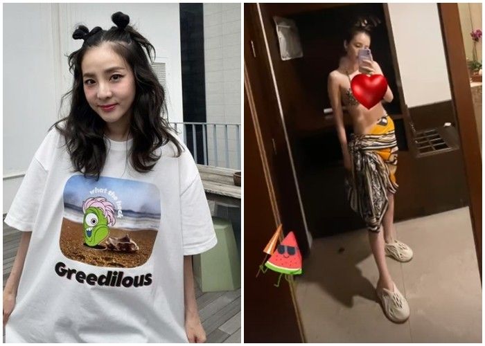 [방송]'37kg' 산다라박, 말라도 너무 말랐네...뼈가 보일 정도 [리포트:컷] | YTN